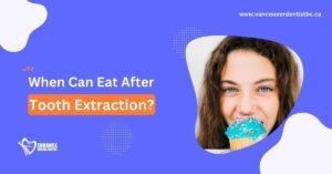 When Can We Eat After Tooth Extraction? - Enhance Dental CA