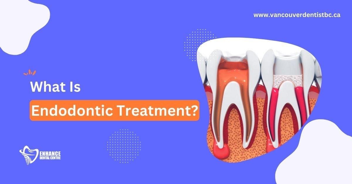 What is Endodontic Treatment? – The Toothache Terror – Enhance Dental care