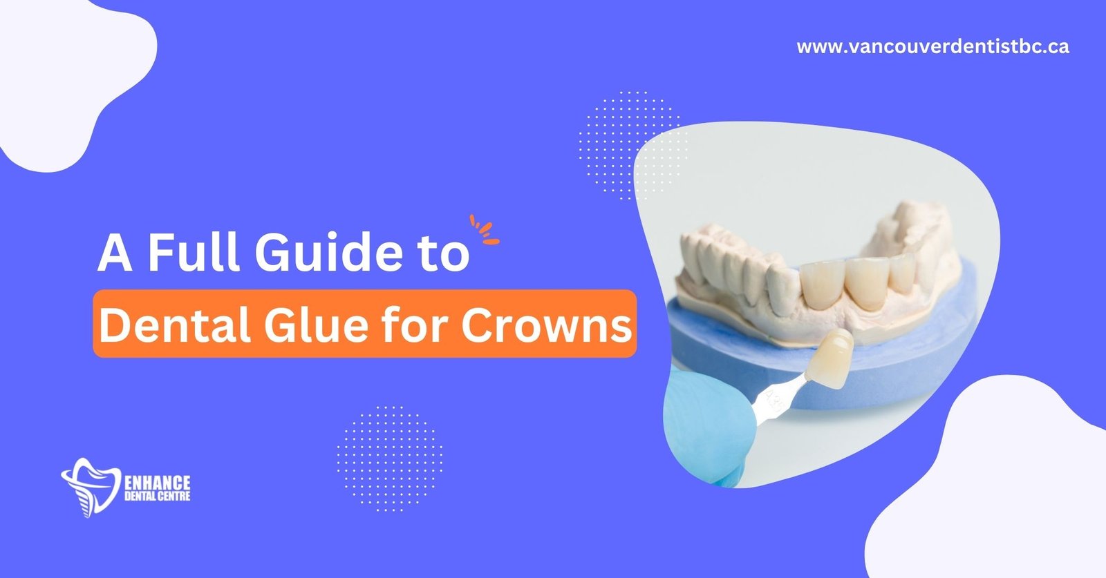 A Full Guide to Dental Glue for Crowns Enhance Dental CA