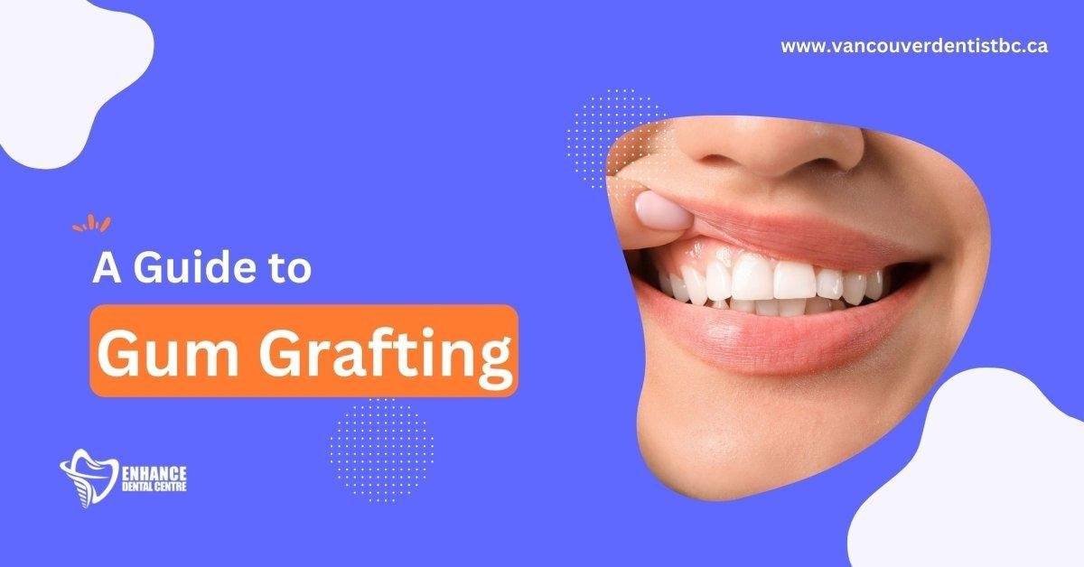 A Guide to Gum Grafting + Before & After Photos – Enhance Dental care