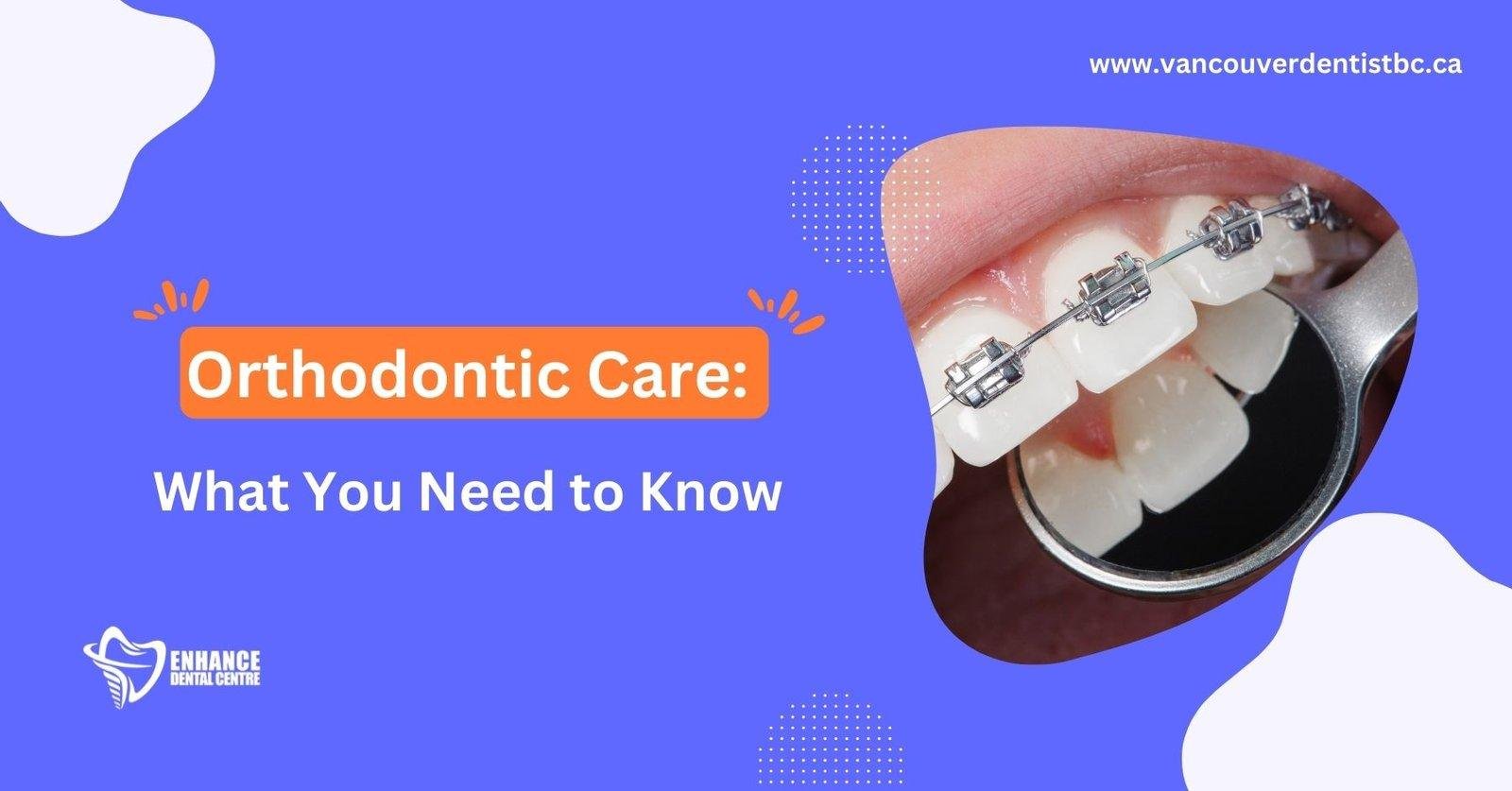 Orthodontic Care: What You Need to Know – Enhance Dental care