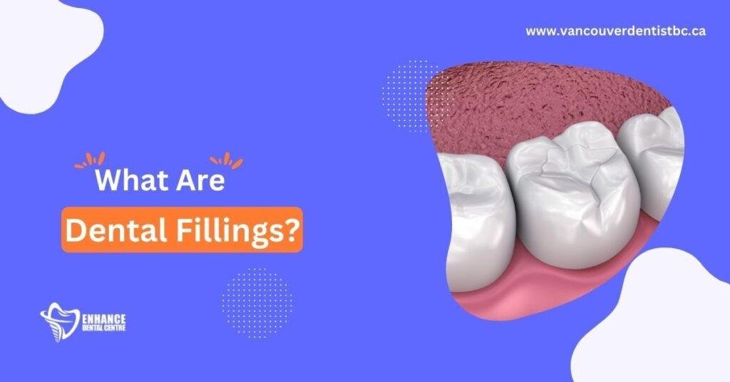 What Are Dental Fillings? – Enhance Dental care