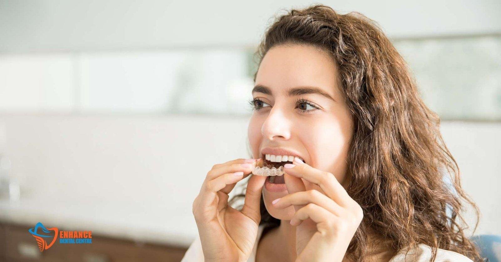 Invisalign Vs. Spark Clear Aligners: Pros, Cons and Key Differences ...