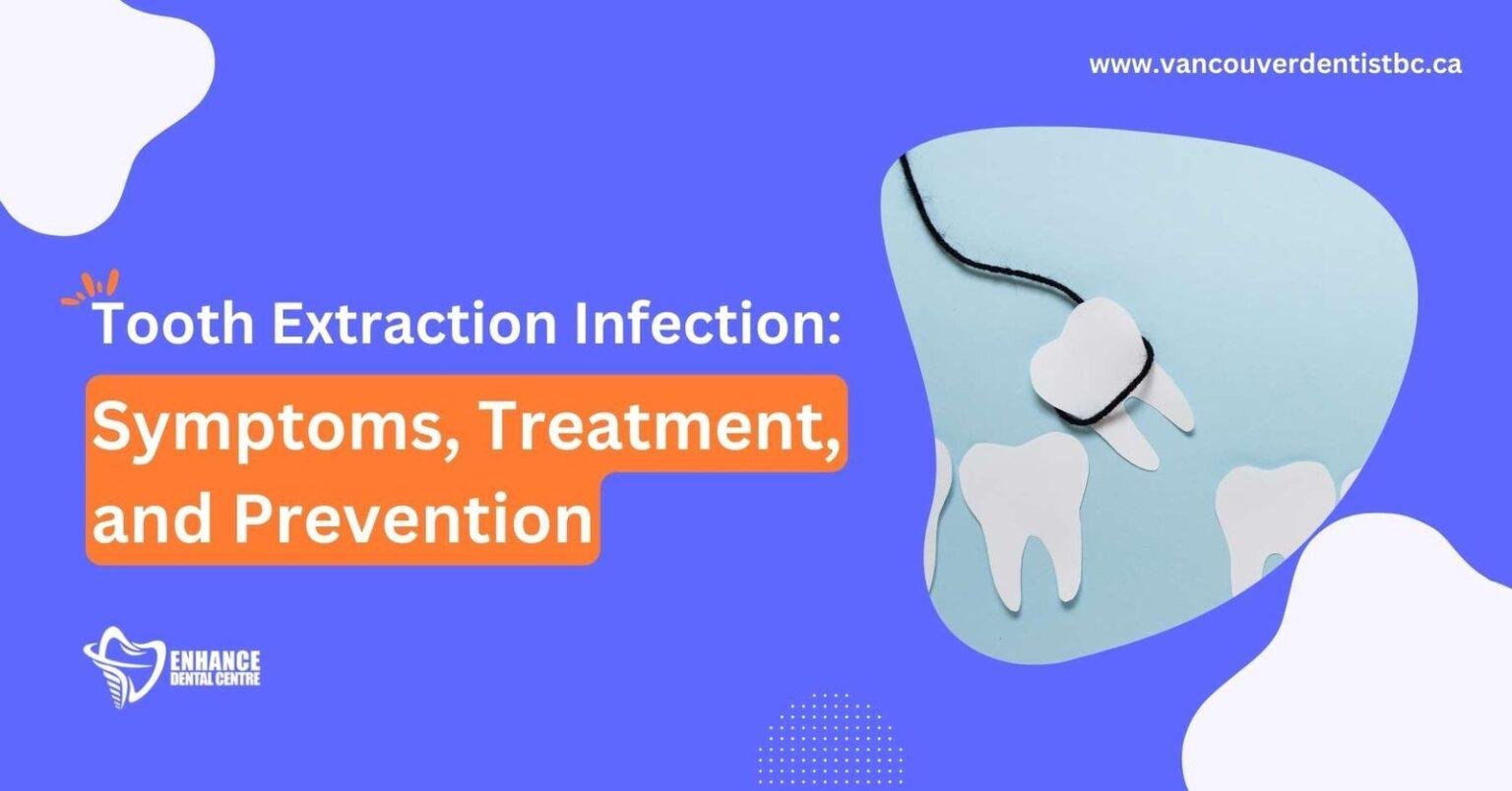 Tooth Extraction Infection: Symptoms, Treatment, and Prevention ...