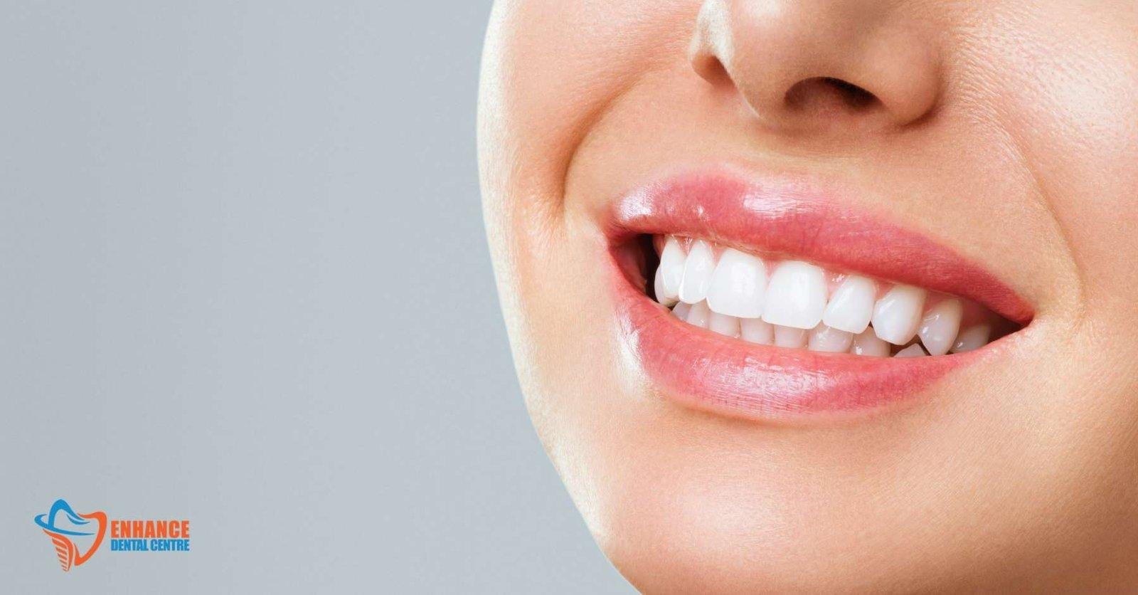Can You Get Invisalign for Top Teeth Only? – Enhance Dental care