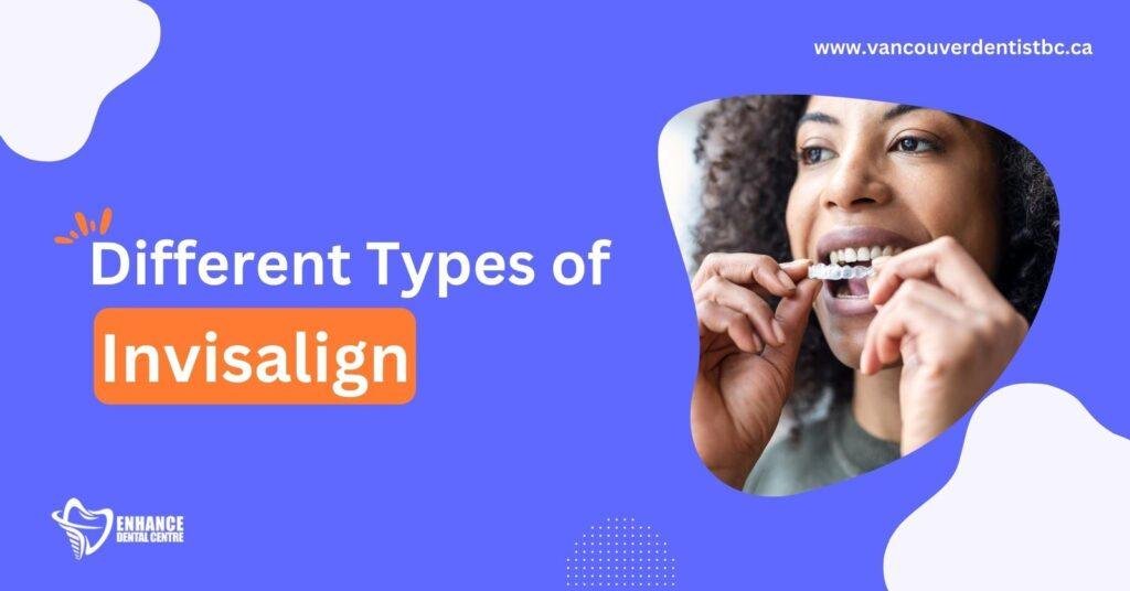 Different Types of Invisalign - Enhance Dental CA