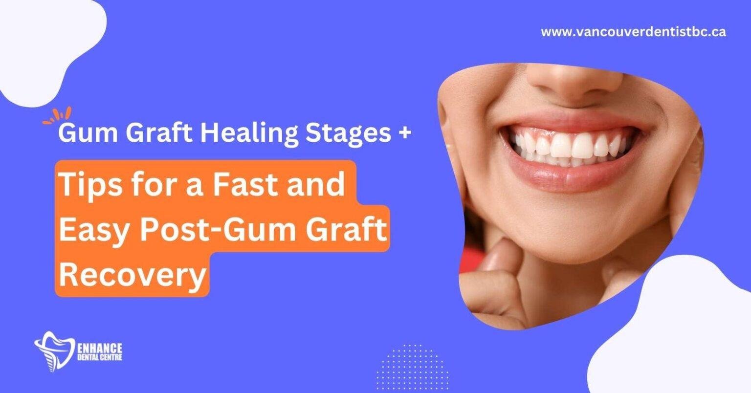 Gum Graft Healing Stages + Tips for a Fast and Easy Post-Gum Graft ...
