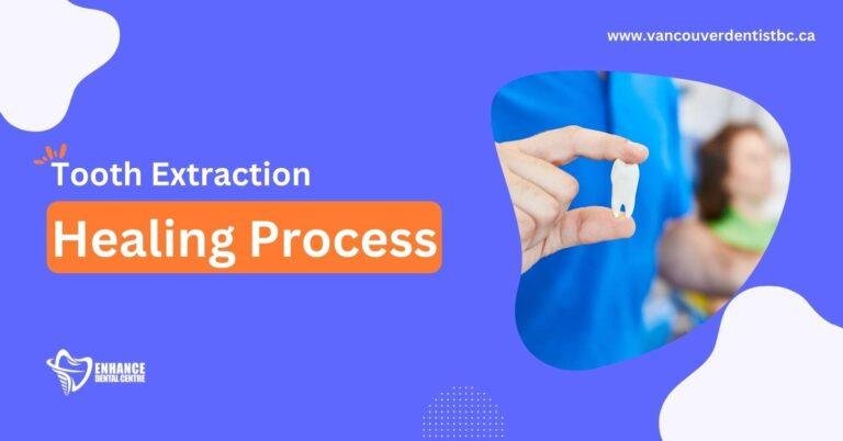 Tooth Extraction Healing Process – Enhance Dental care