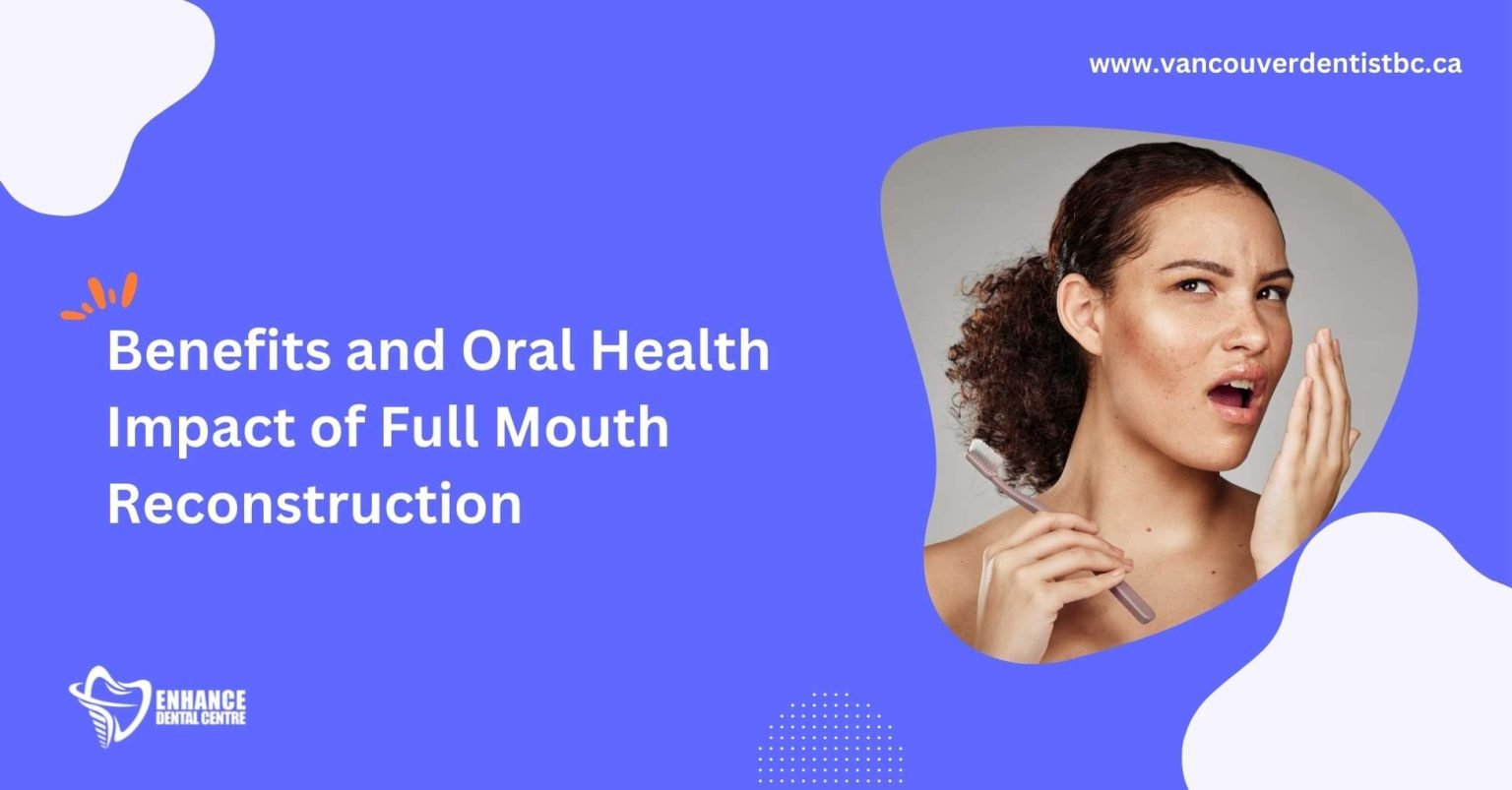 Full Mouth Reconstruction: Benefits & Impacts on Oral Health! - Enhance ...
