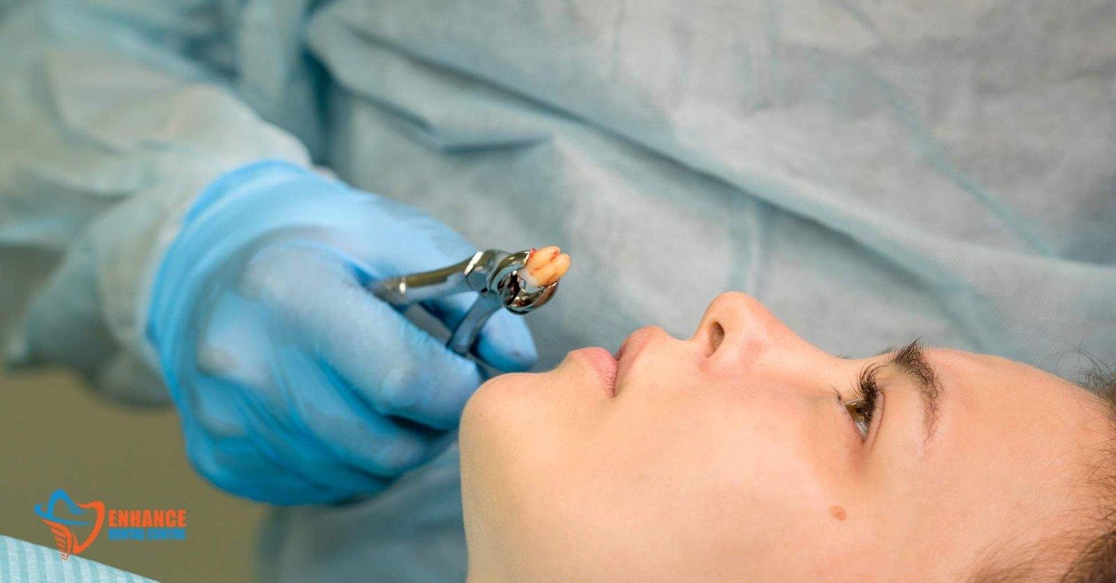 Wisdom Tooth Extraction Recovery Timeline: What to Expect? – Enhance ...