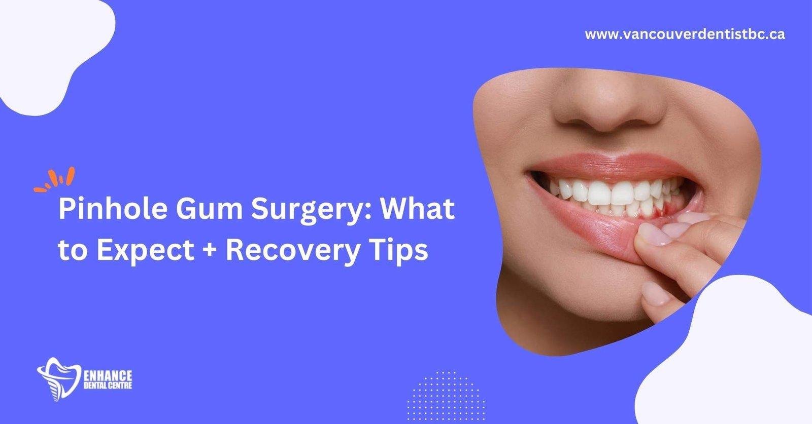 Pinhole Gum Surgery: What to Expect + Recovery Tips – Enhance Dental care