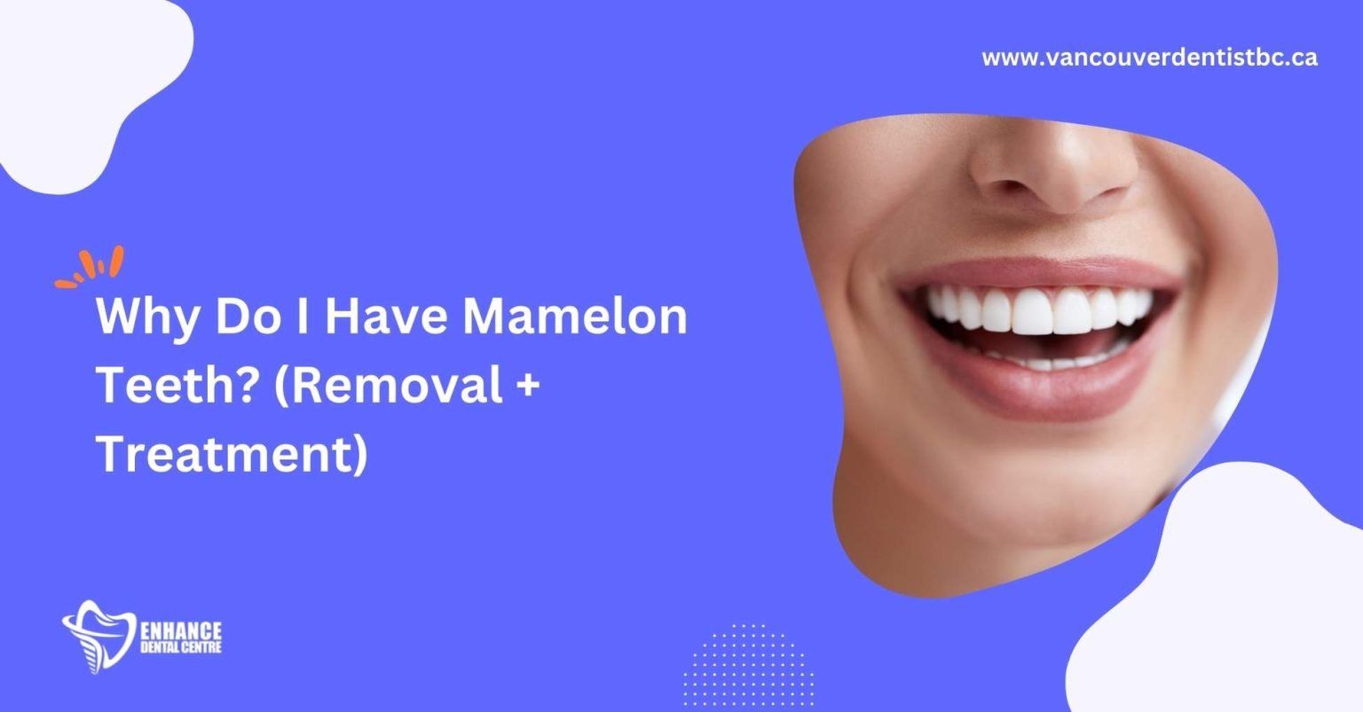 Why Do I Have Mamelon Teeth? (Removal + Treatment)