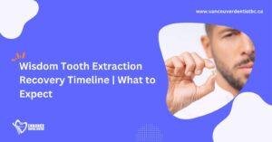 Wisdom Tooth Extraction Recovery Timeline: What to Expect? – Enhance ...