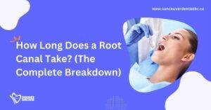 How Long Does a Root Canal Take? (The Complete Breakdown!) – Enhance ...