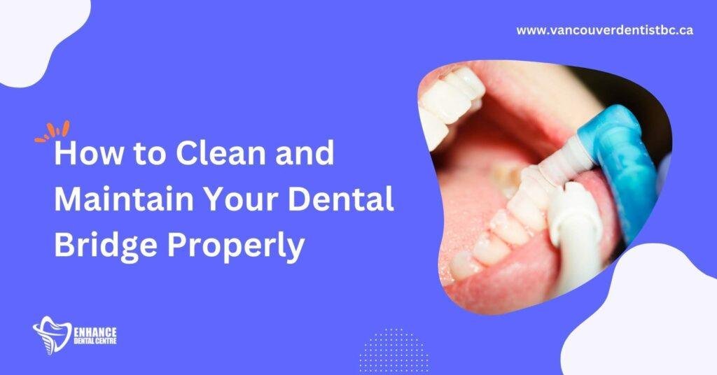 How to Clean and Maintain Your Dental Bridge Properly – Enhance Dental care