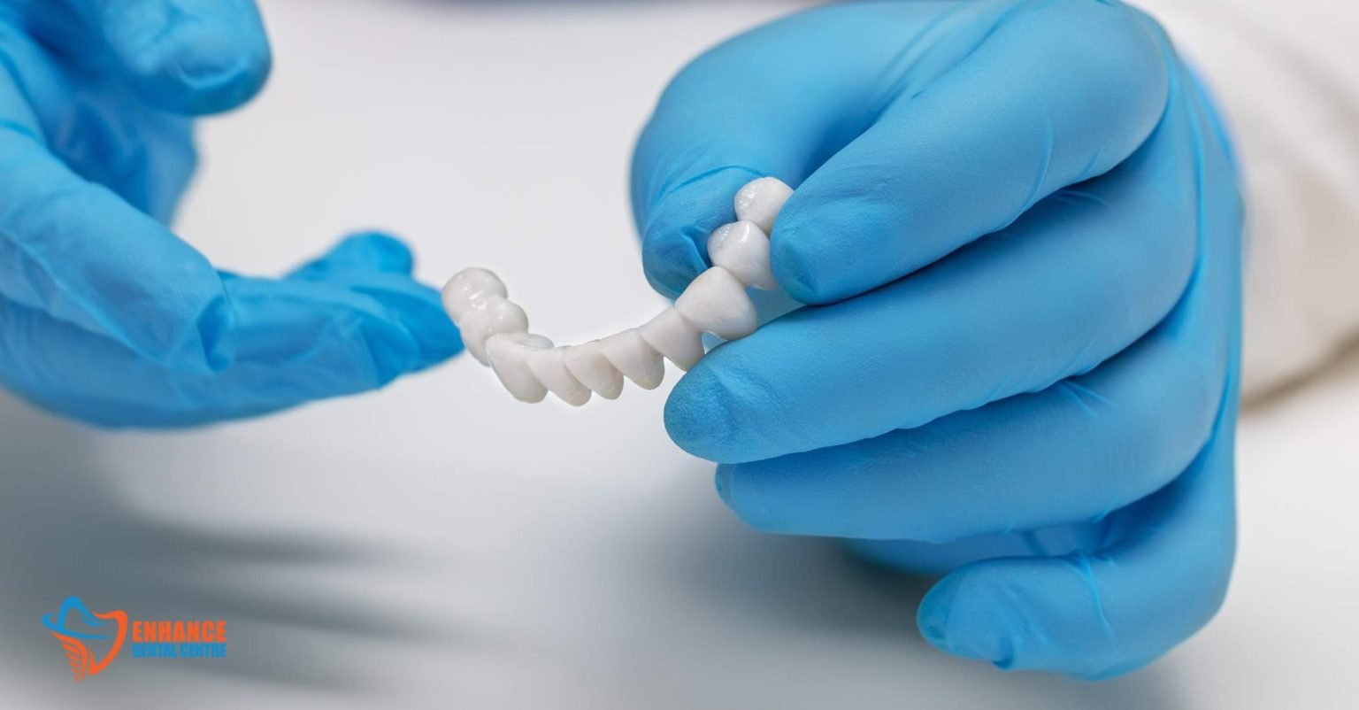 How to Clean and Maintain Your Dental Bridge Properly - Enhance Dental CA