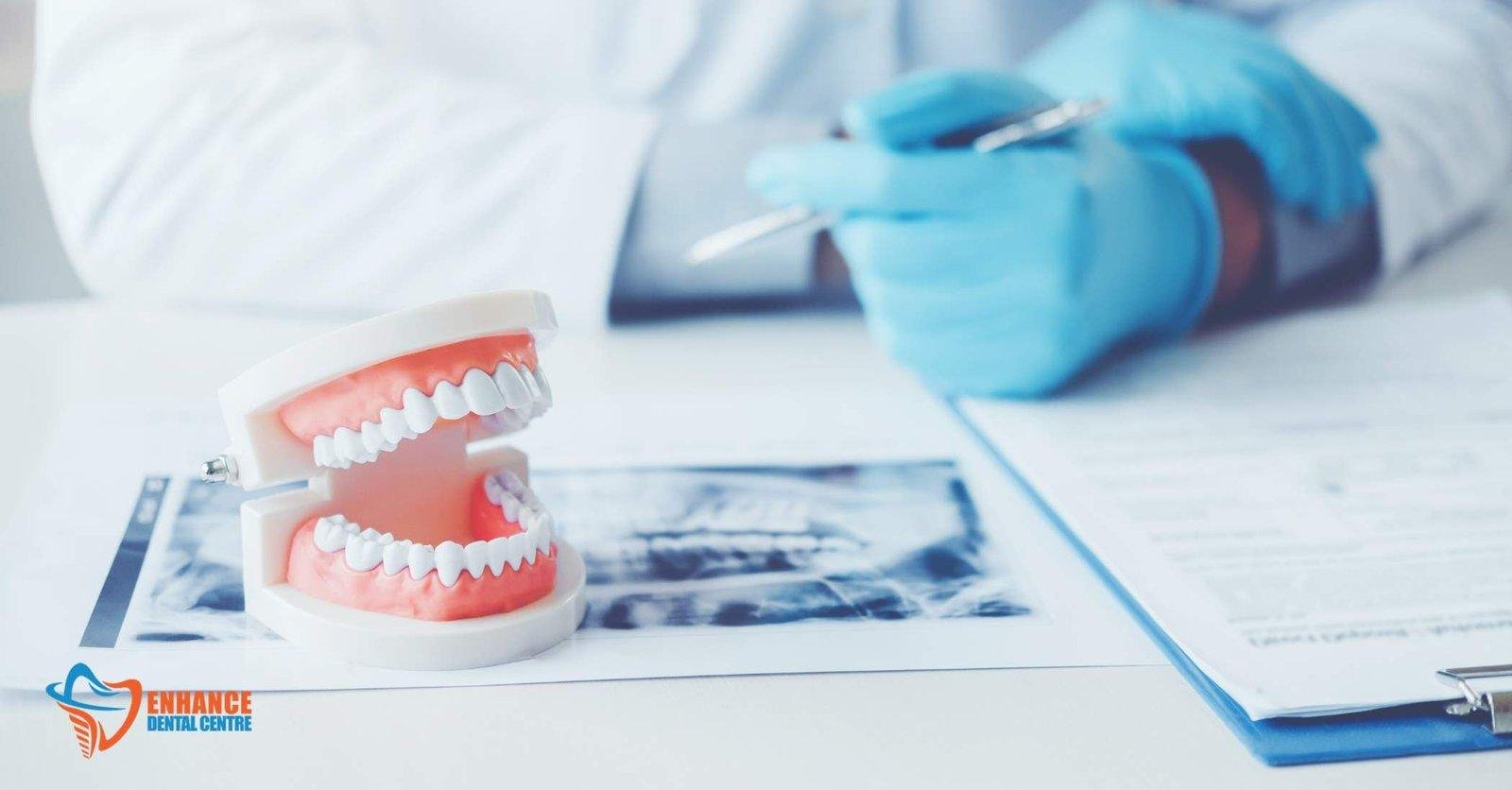 Oral Cancer Screening: Guidelines and Early Detection Tips! – Enhance ...