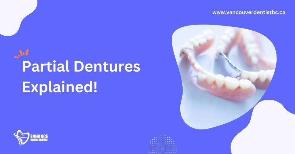 Everything You Need to Know About Partial Dentures! – Enhance Dental care