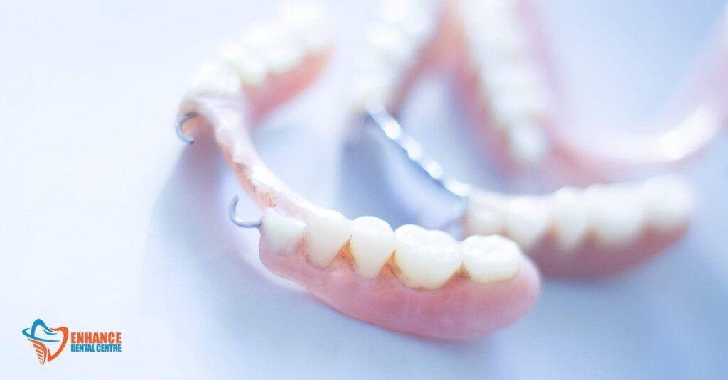 Everything You Need to Know About Partial Dentures! – Enhance Dental care
