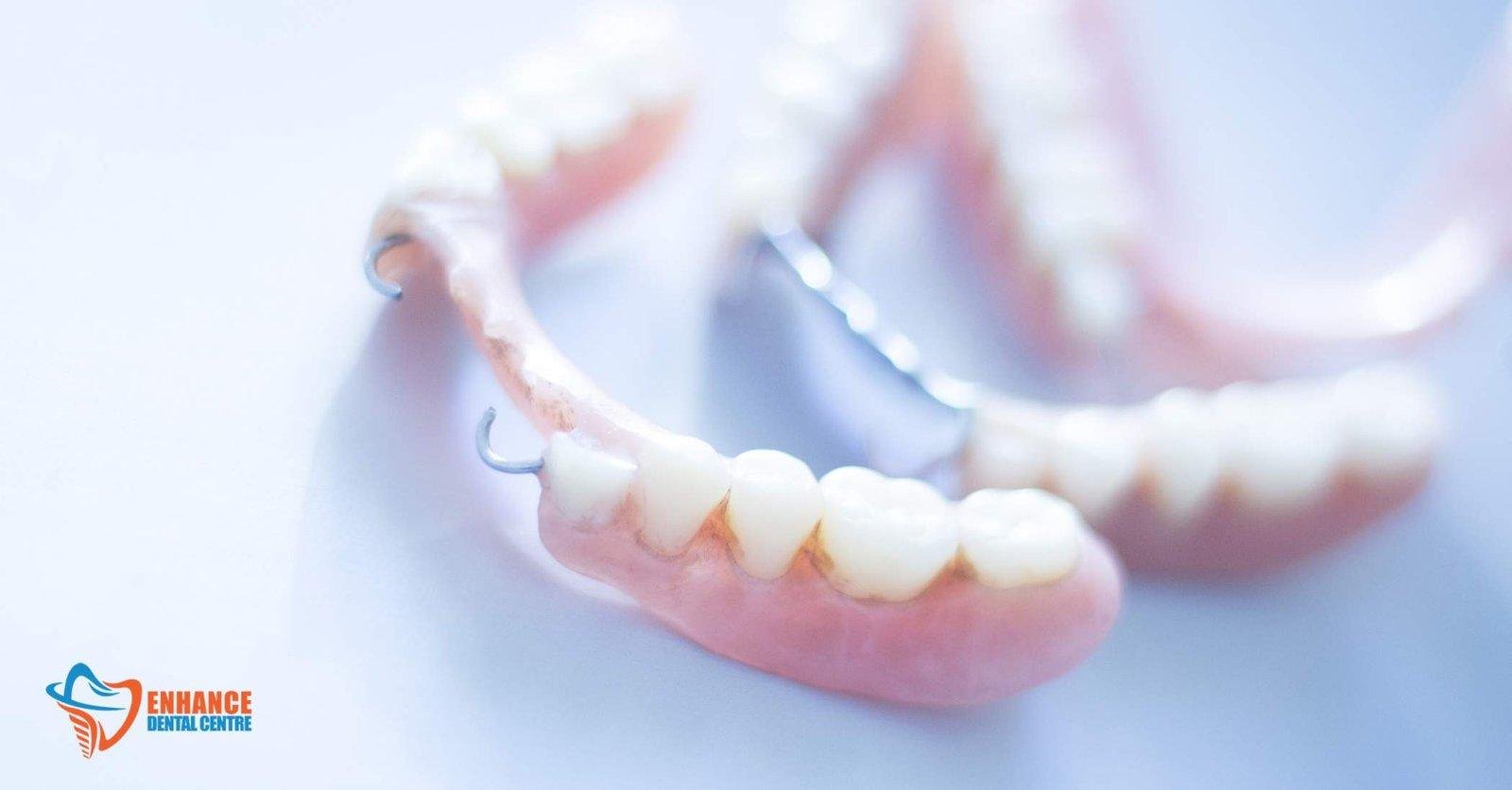 Everything You Need to Know About Partial Dentures! – Enhance Dental care