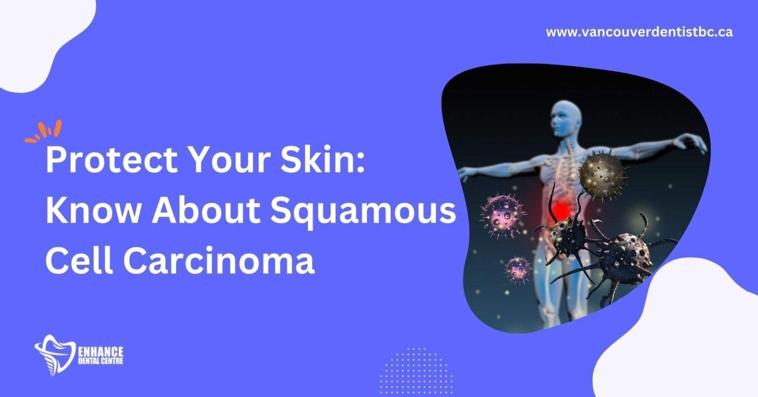 Your Full Guide to Oral Squamous Cell Carcinoma! – Enhance Dental care