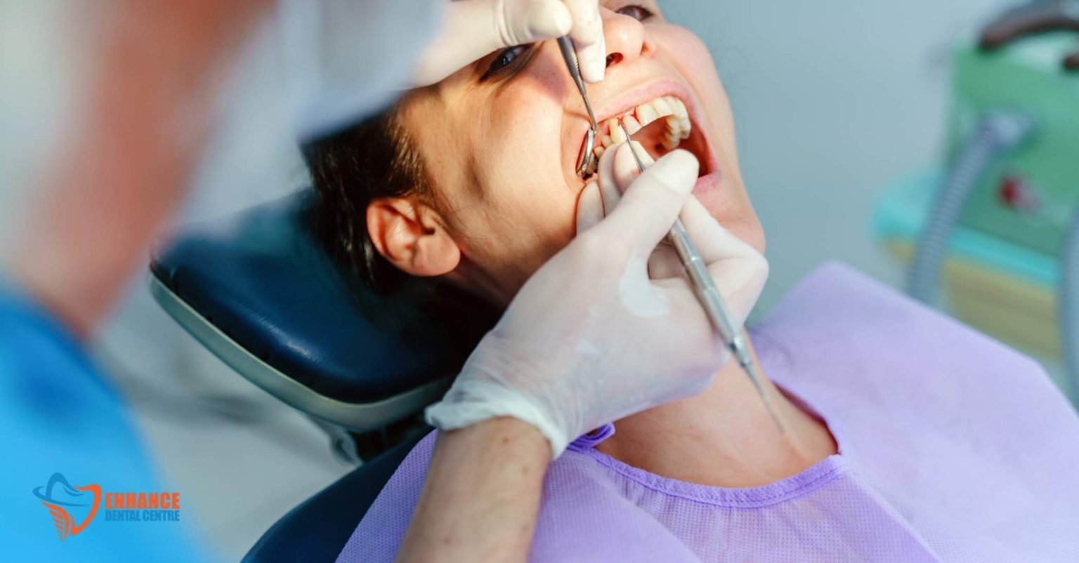 What is Lip & Oral Cancer: Stages, Symptoms, and Treatments!