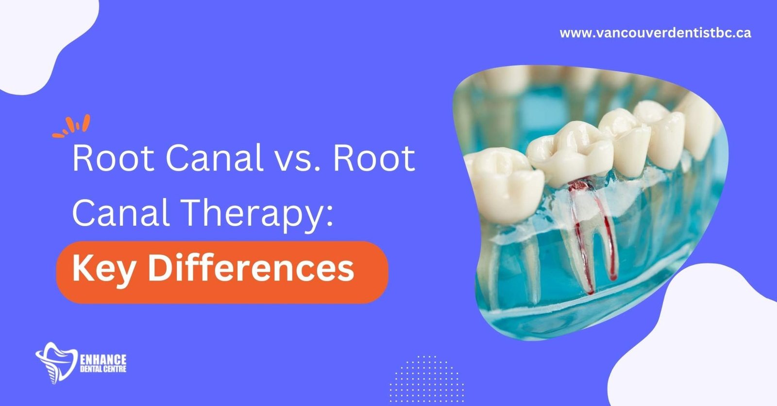How Long Does a Root Canal Take? (The Complete Breakdown!) - Enhance ...