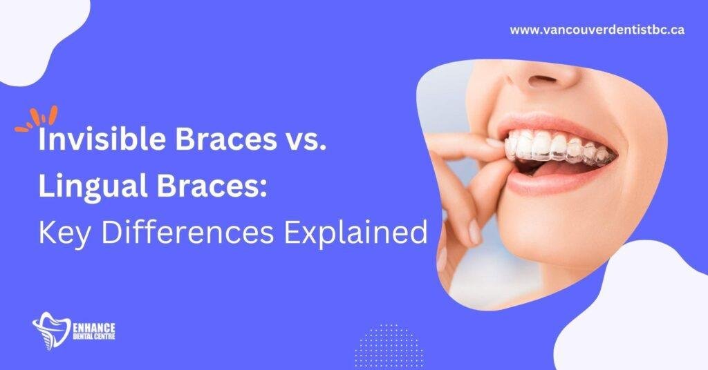 How to Choose Between Invisible and Lingual Braces? – Enhance Dental care